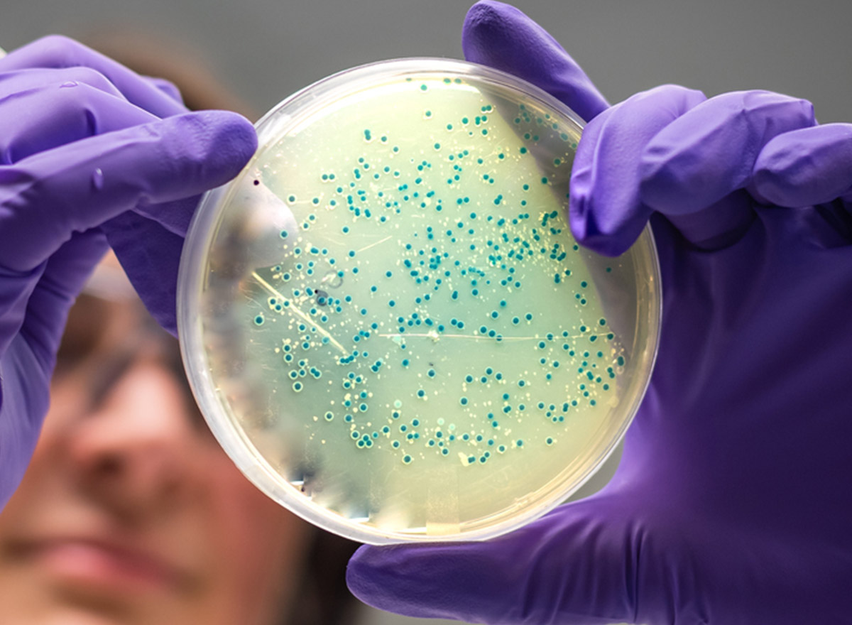 Bacterial Cultures And Culture Techniques at Walter Stuck blog